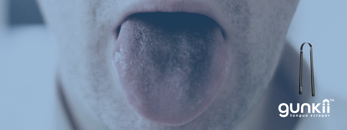 Black hairy tongue – Gunkii